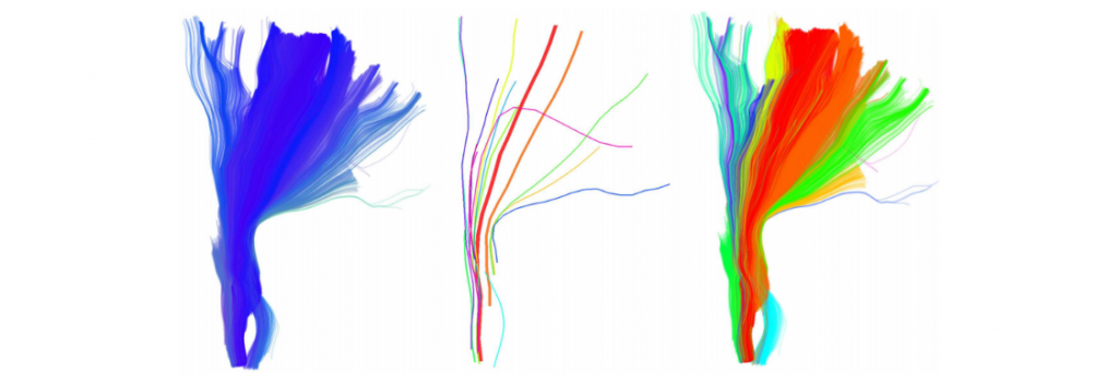 Neuroimaging Algorithms For Gps Trajectories Clustering Hn Machine Learning En
